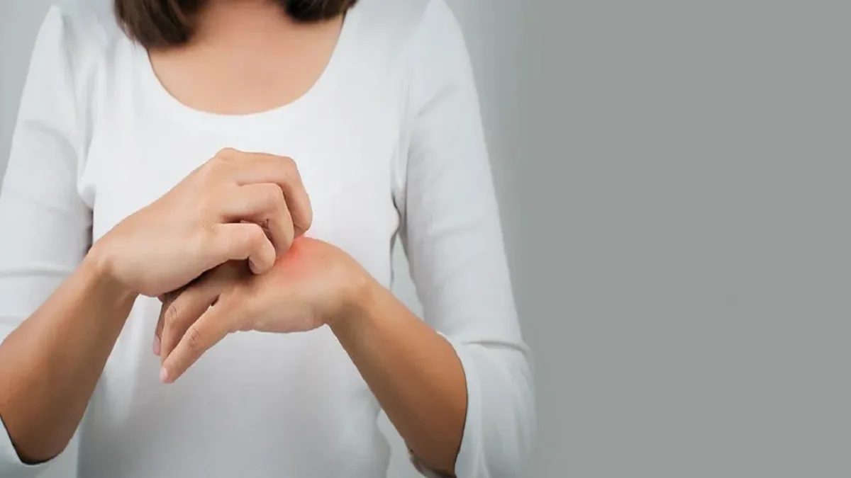 Dyshidrosis on Hands and Feet: What is Dyshidrotic Eczema and How to ...