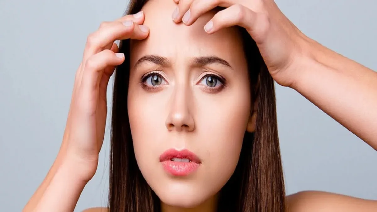 Pimples on Forehead: Causes, Treatment and Prevention - Times Bull